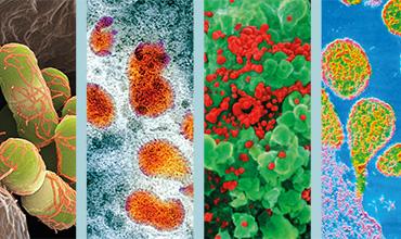 Interactive disease atlas