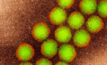 Poliomyelitis